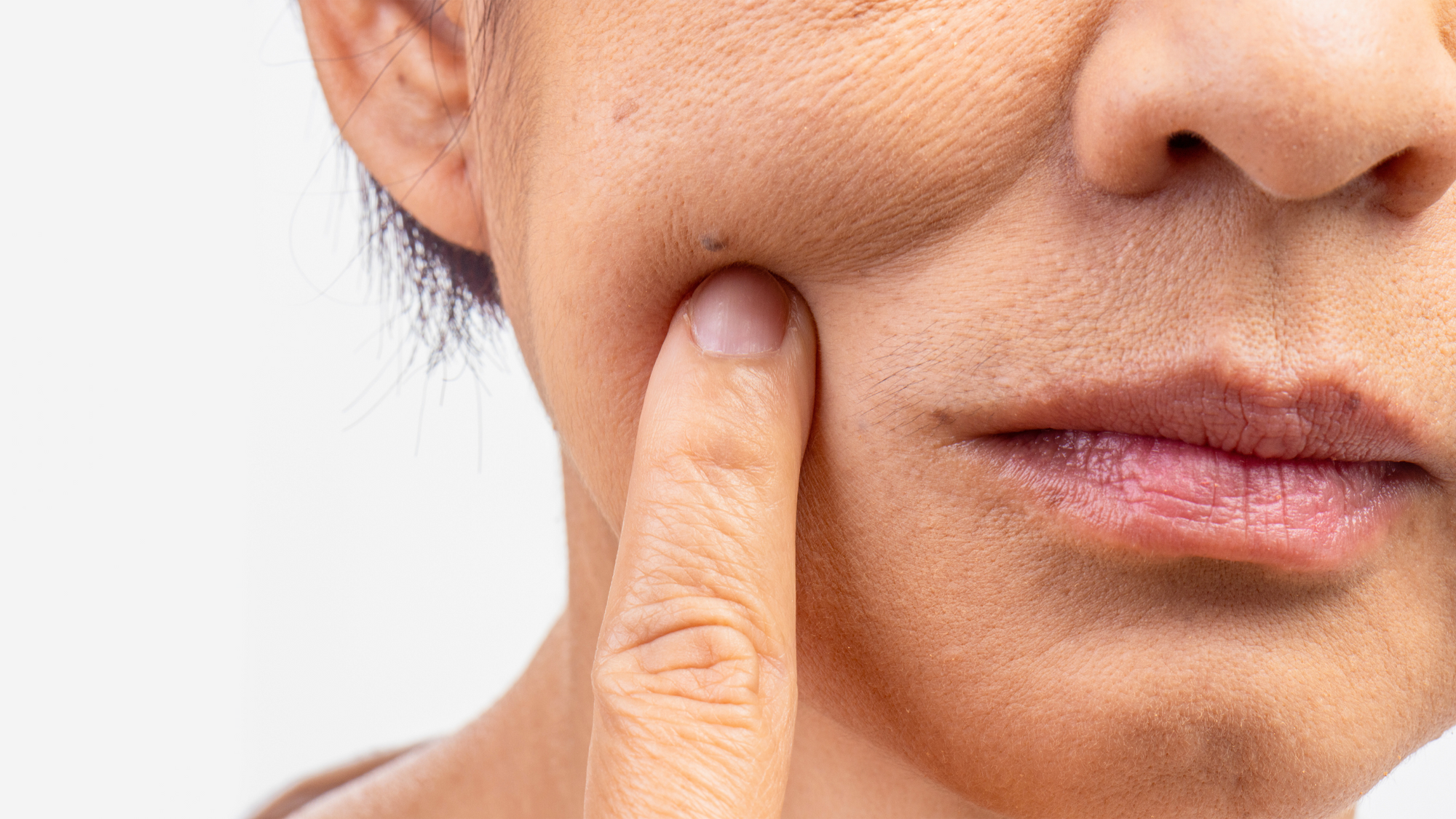 Signs of Dehydrated vs. Dry Skin: Understanding the Difference and How ...